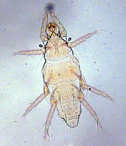 ‘It’s going to happen again’: Biting mites an issue for some following ...