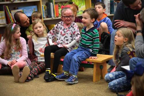 Skin as fragile as butterfly's wings: the 'worst disease you've never ...