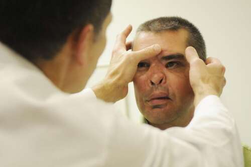 Three people with disfiguring injuries learn to live with their new looks