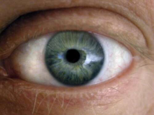 Multiple genes determine eye color