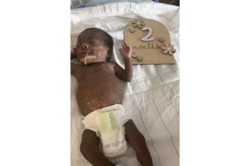 ‘Micropreemie' baby who weighed just over 1 pound at birth goes home ...